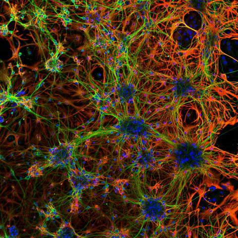 The Laboratory of Hybrid Materials for the Bioengineering of Interface ...