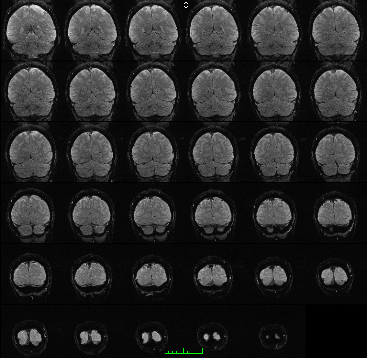 Magnetic Resonance Functional Imaging Lab (MRFIL) | Neuroscience ...