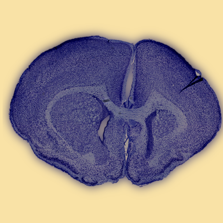 Cellular Neuroscience Imaging Laboratory | Neuroscience Program | Illinois